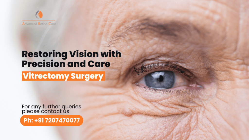 Vitrectomy Surgery: Restoring Vision with Precision and Care | Advanced ...