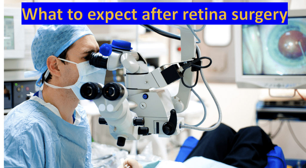 What to expect after Retina Surgery? | Advanced Retina Care